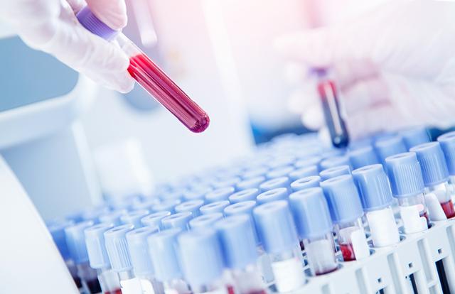 VSH: Ce este, care sunt valorile normale și ce semnifică un VSH crescut ...